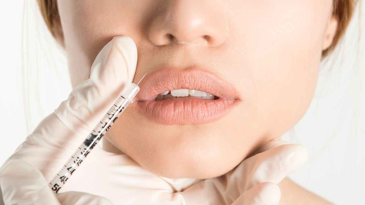 Perfectly Pouty: Where to Inject Botox for Lip Flip Magic