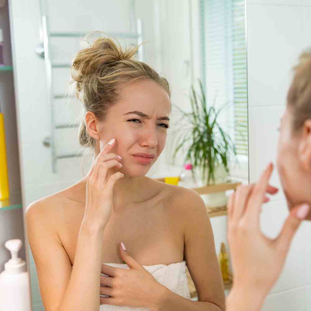 Dry Skin And Acne Dilemma Can Dry Skin Cause Breakouts